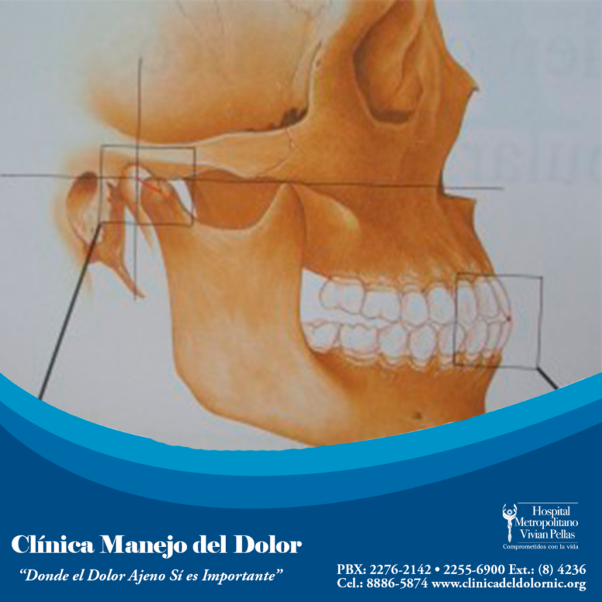 DISFUNCIÓN DE LA ARTICULACIÓN TÉMPORO-MANDIBULAR - Clínica del Dolor Dr ...